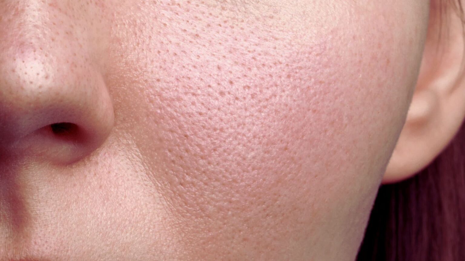 17 Effective Treatments for Grainy Skin Texture on Face | TheBeautyFoodie