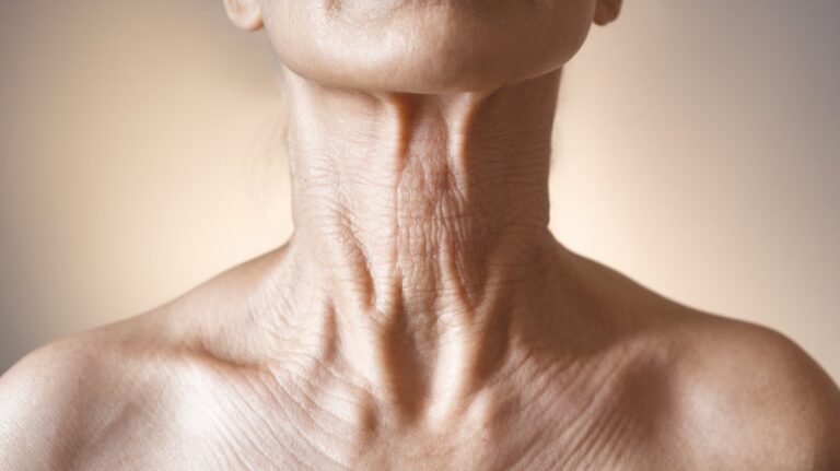 How to Get Rid of Neck Lines: 9 Ways | TheBeautyFoodie