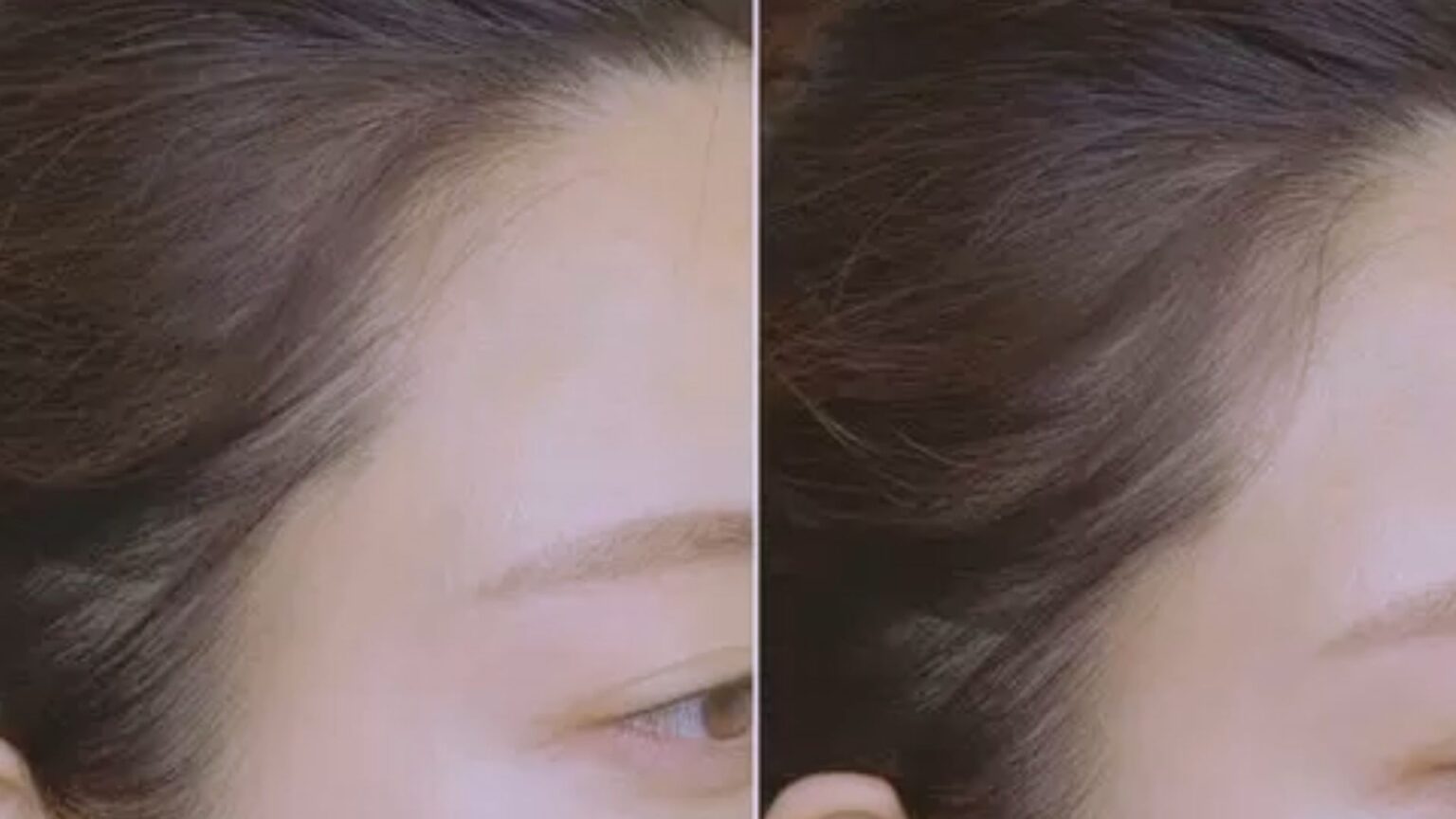 How to Get a Smaller Forehead: From Surgery to Makeup | TheBeautyFoodie