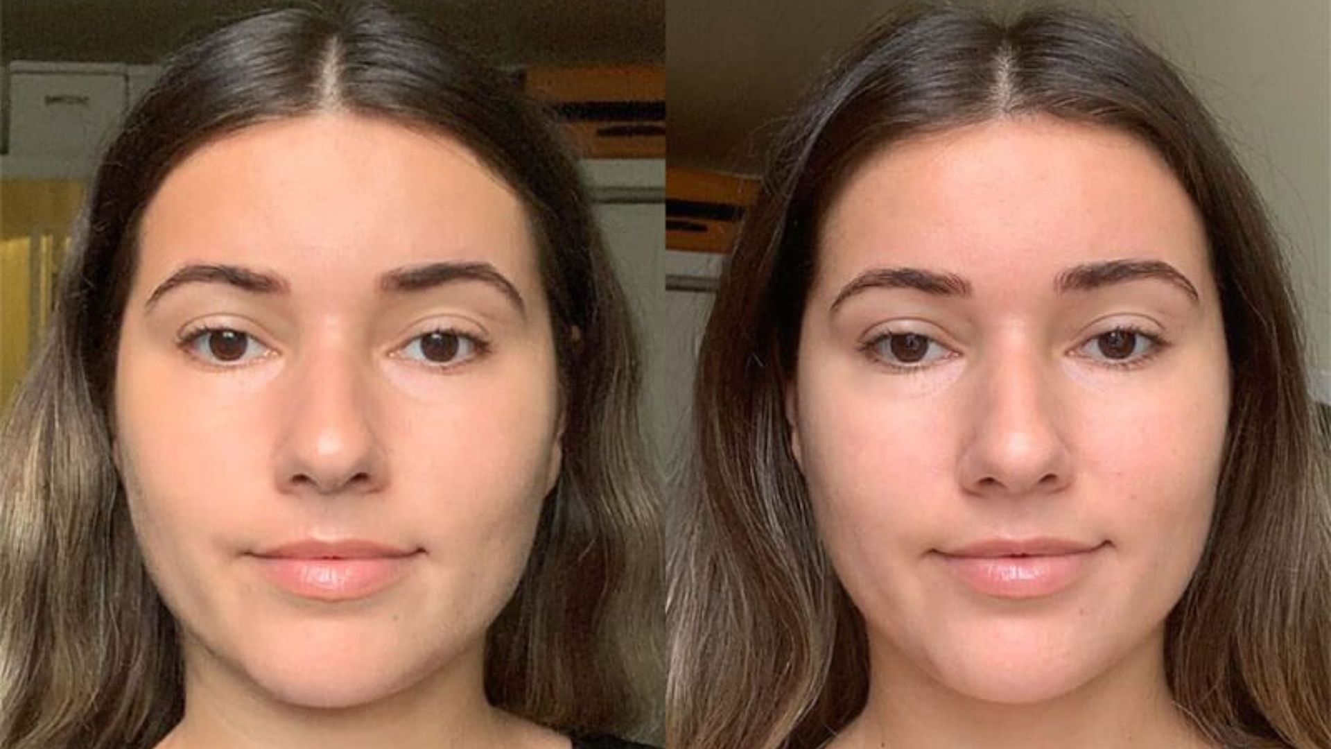 Red Light Mask Before and After: Does It Really Work? | TheBeautyFoodie