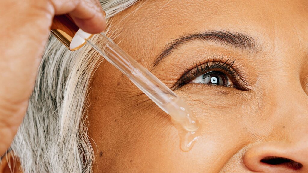 How to Remove Age Spots Naturally: Effective Tips & Remedies ...
